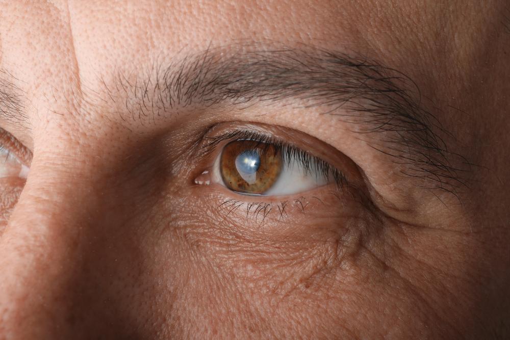 Cataract Surgery: What To Expect Before And After